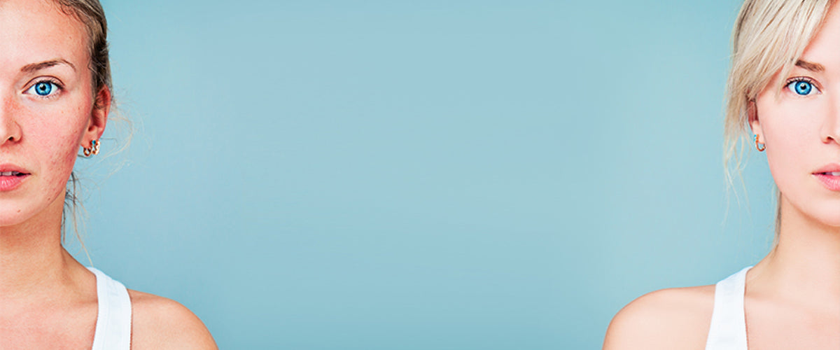 Macular Shield™ Zinc Free – AREDS2-Based - Doctor's Advantage® – PRN ...