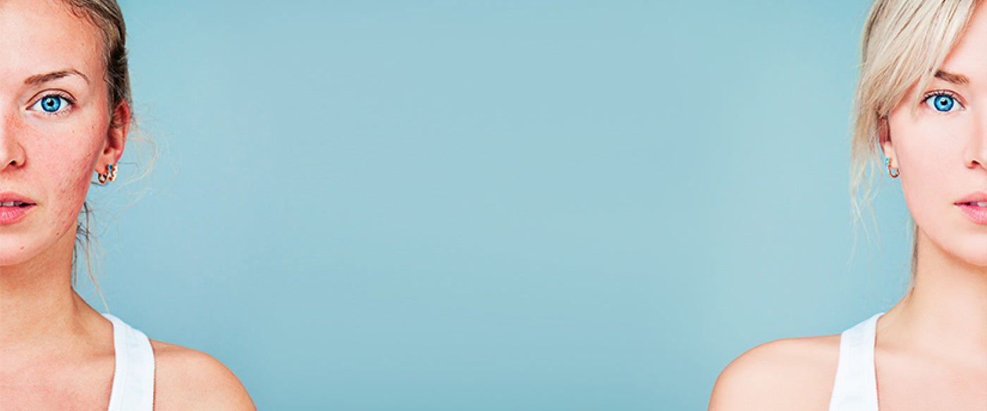 Macular Shield™ Zinc Free – AREDS2-Based - Doctor's Advantage® – PRN ...