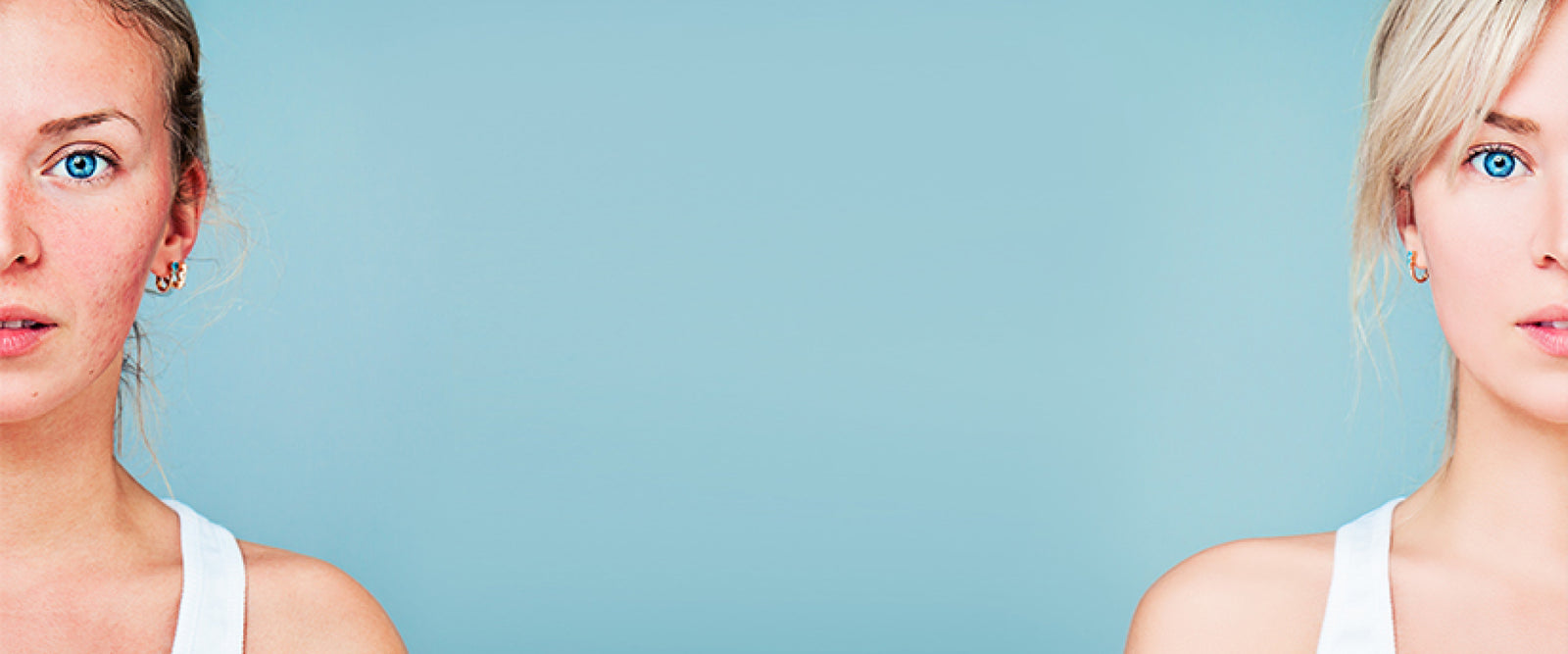 Gentle Eyelid and Skin Light Foam Cleanser By Cliradex – PRN Vision Group