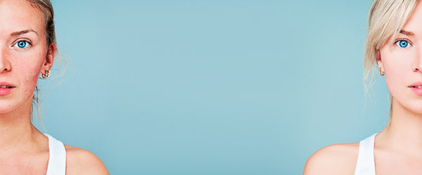 Macular Shield™ Zinc Free – AREDS2-Based - Doctor's Advantage® – PRN ...